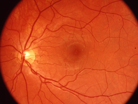 Home – Eyeworks Australia